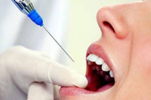 What Are the Common Side Effects of Dental Anesthesia? | UTOdent.com