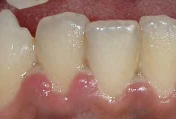 Dentistry and Oral Health Blog